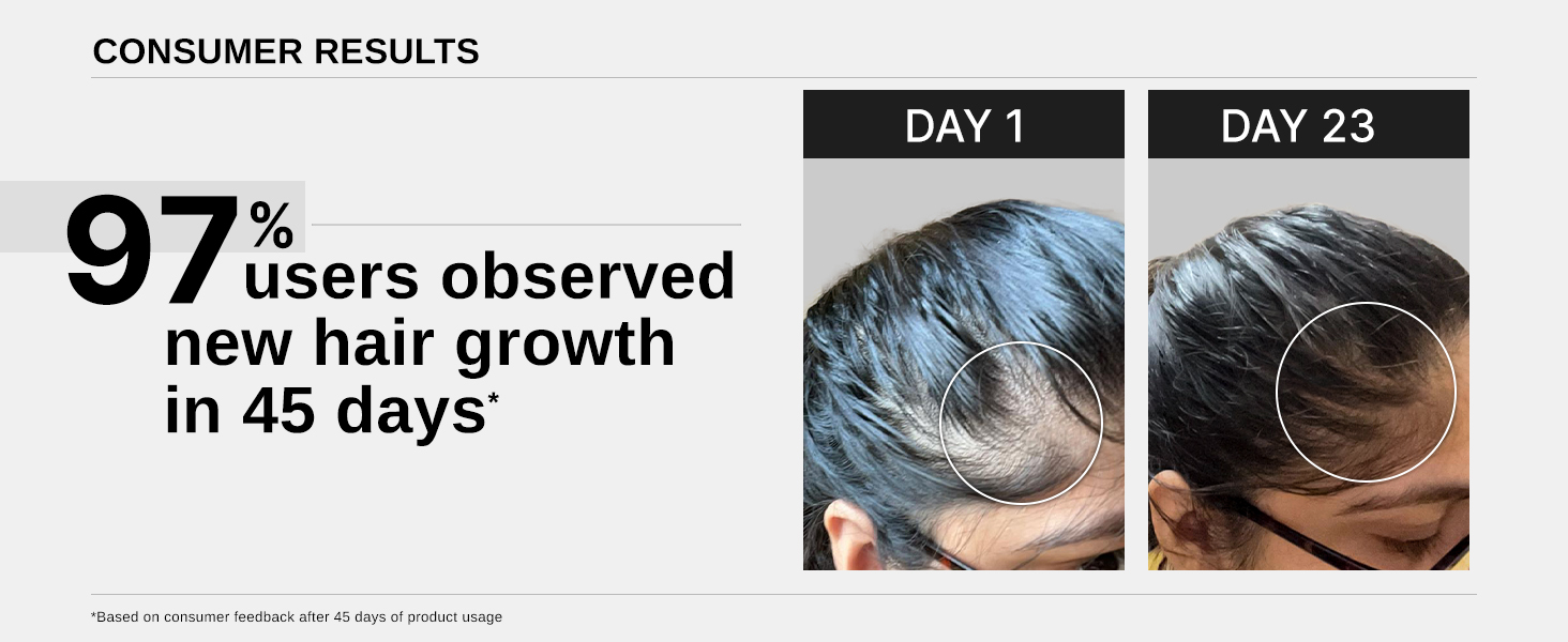 hair_Growth – https://naturalherb.store